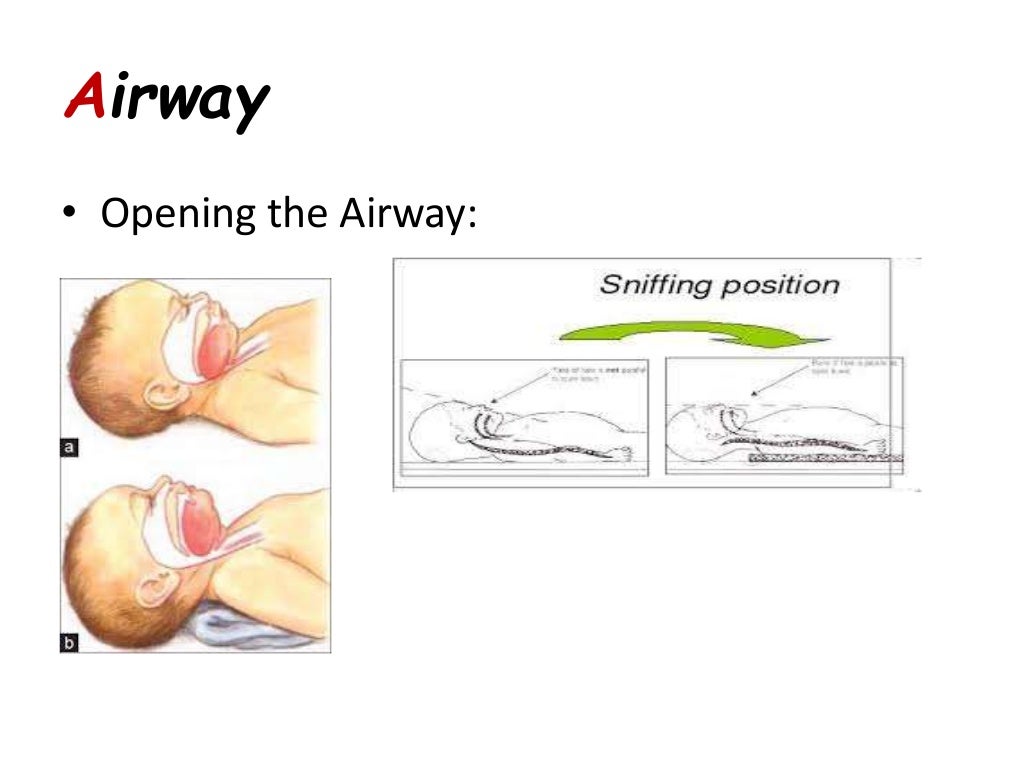 Pediatric Bls for nurses