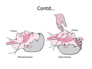 BLS INTRODUCTION.pptx