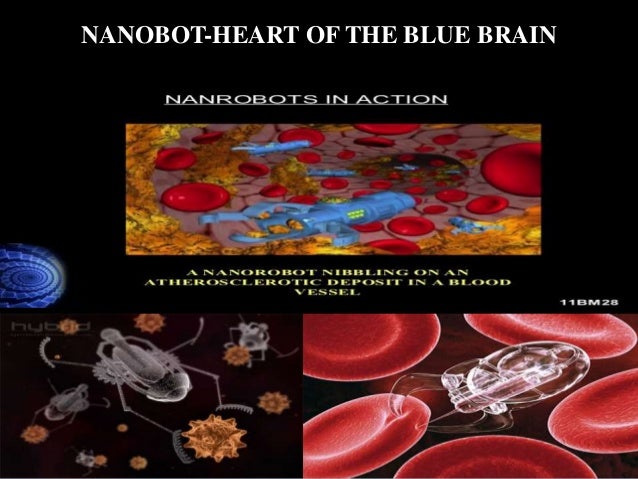 Blue brain Technology