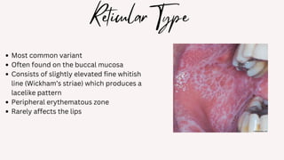 Oral Lichen Planus| Diagnosis, Treatment and Management | PDF