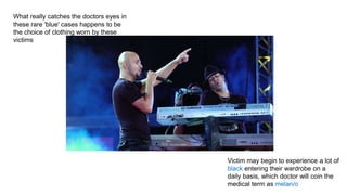 Blue Skin- Integumentary System | PPT