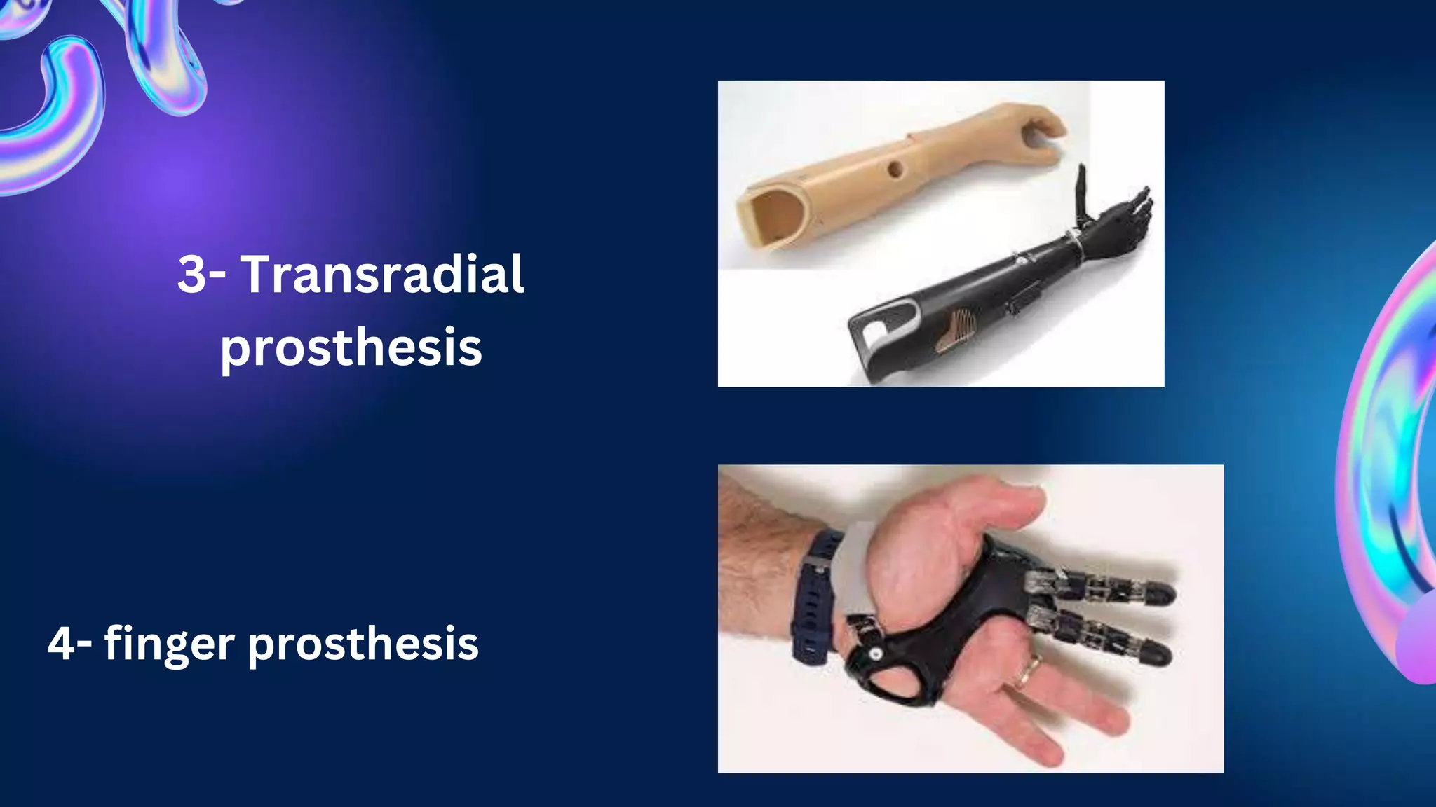 Prosthesis | PPTX