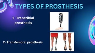 Prosthesis | PPTX