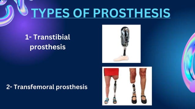 Prosthesis | PPTX | Surgery | Medical Health