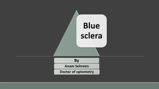 blue sclera.pptx