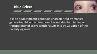 blue sclera.pptx