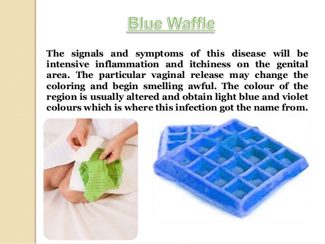 Blue waffle