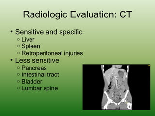 Blunt abdominal trauma | PPT