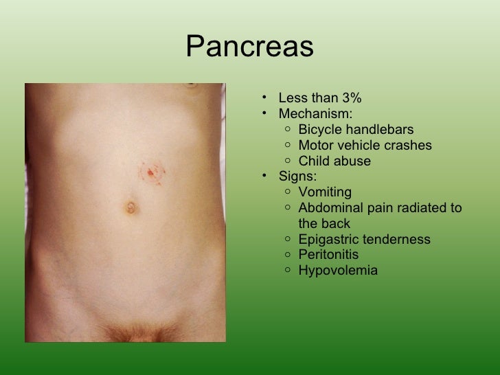 Blunt abdominal trauma