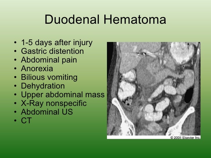 Blunt abdominal trauma