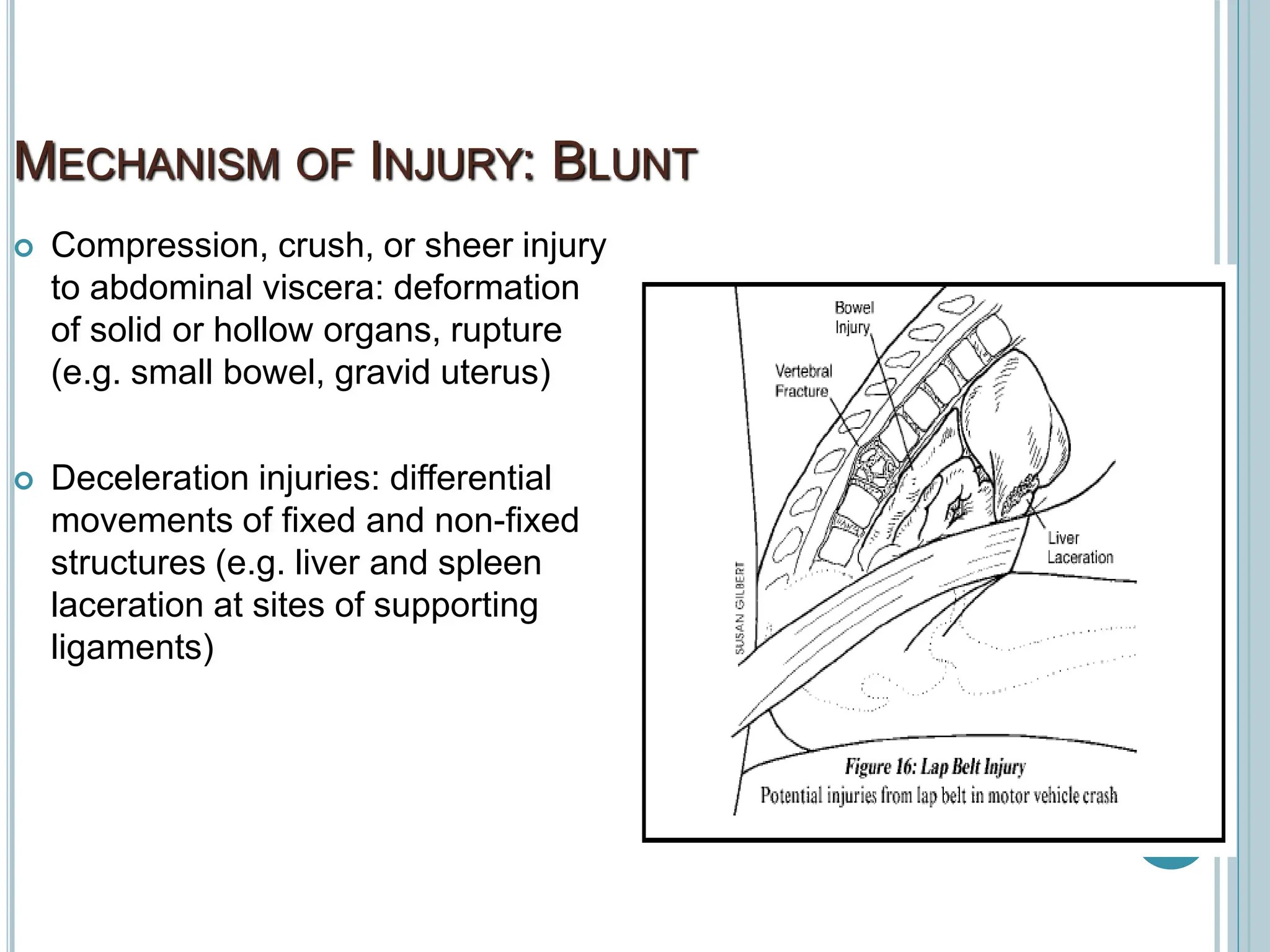 Blunt abdominal trauma.ppt0021.pptx