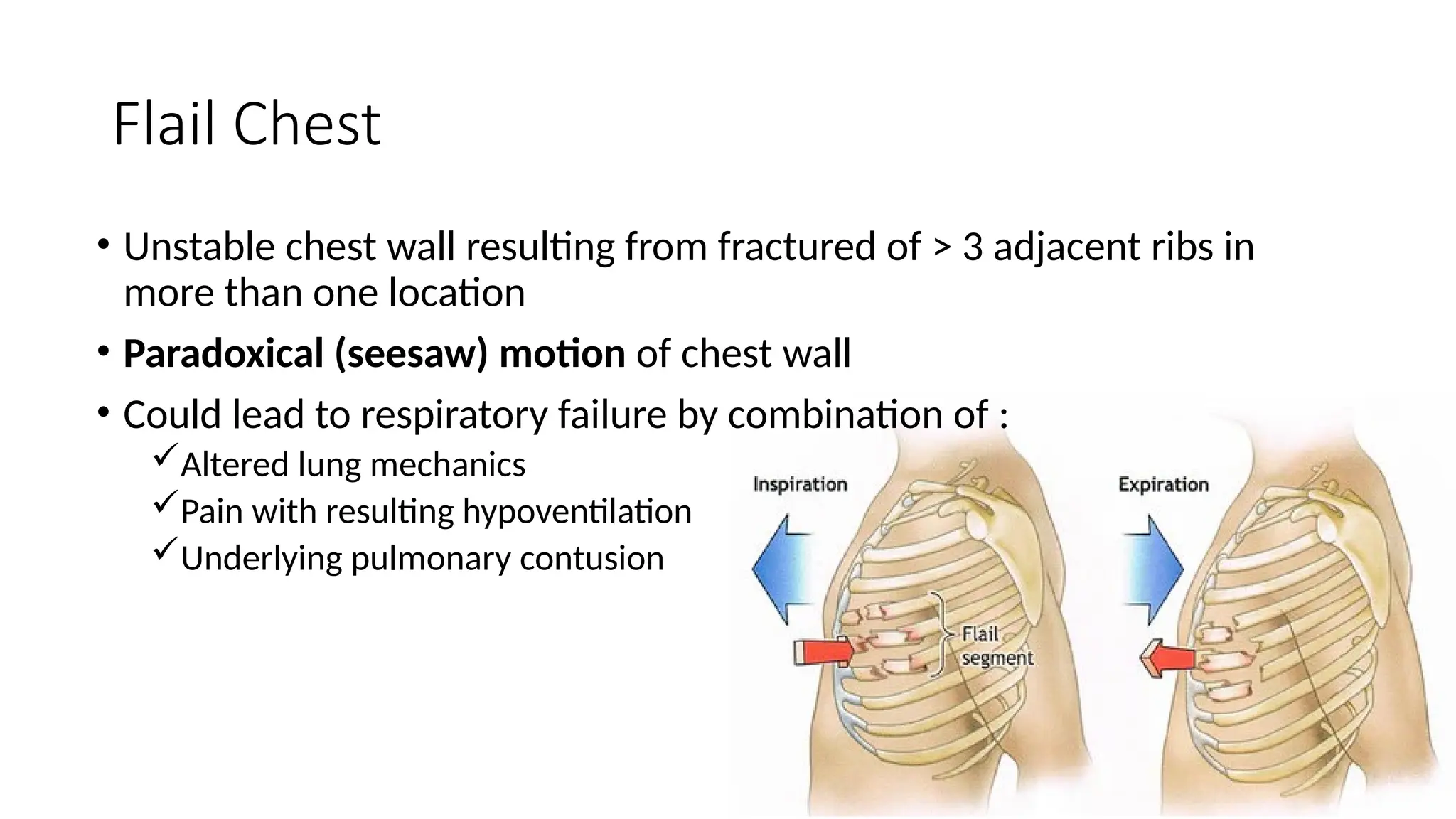Trauma pada dada blunt chest trauma.pptx | First Aid | Injuries