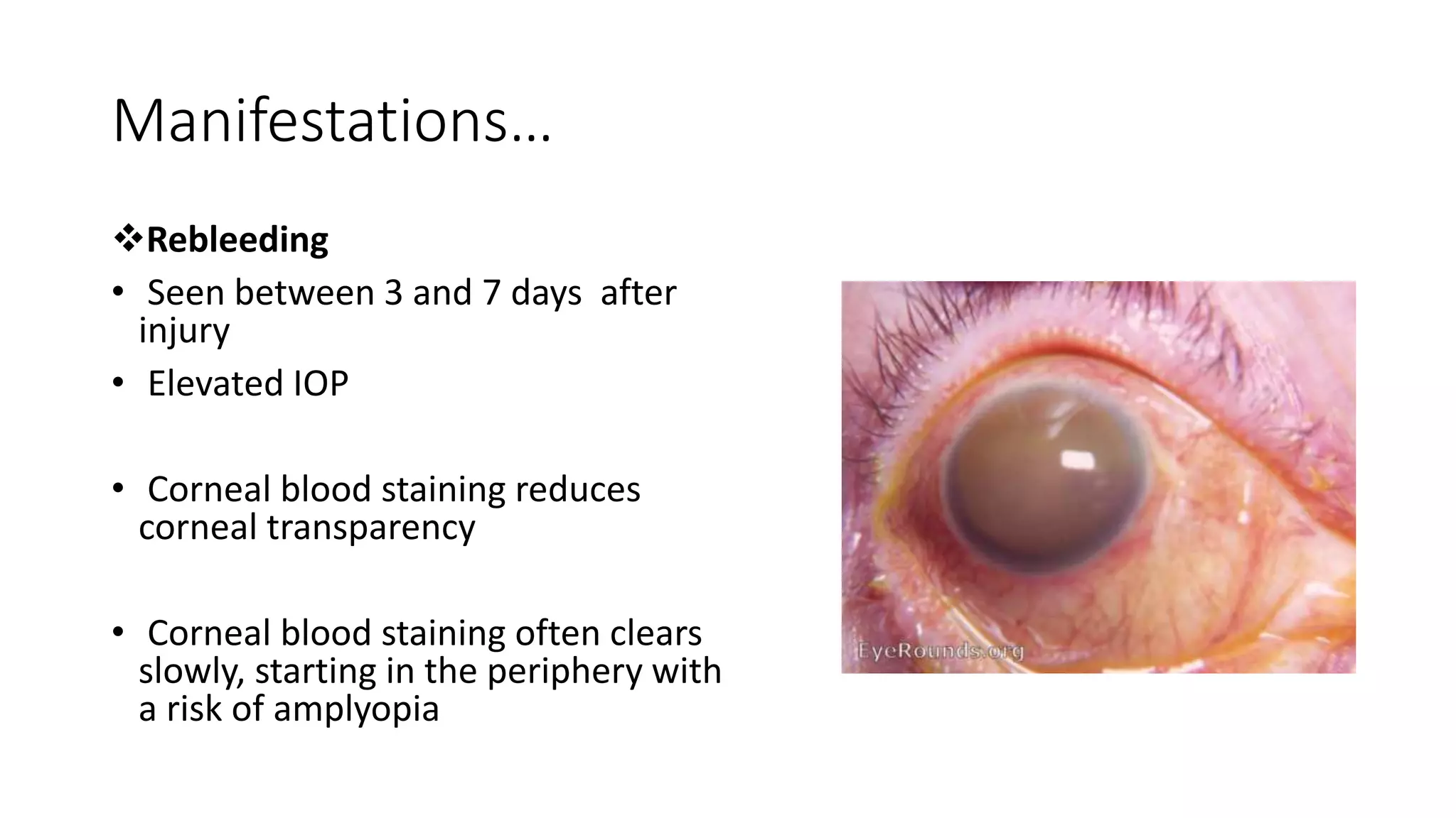 BLUNT EYE TRAUMA.pptx
