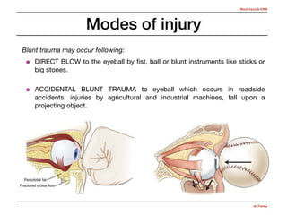 Ocular Blunt injury | PDF