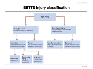 Ocular Blunt injury | PDF