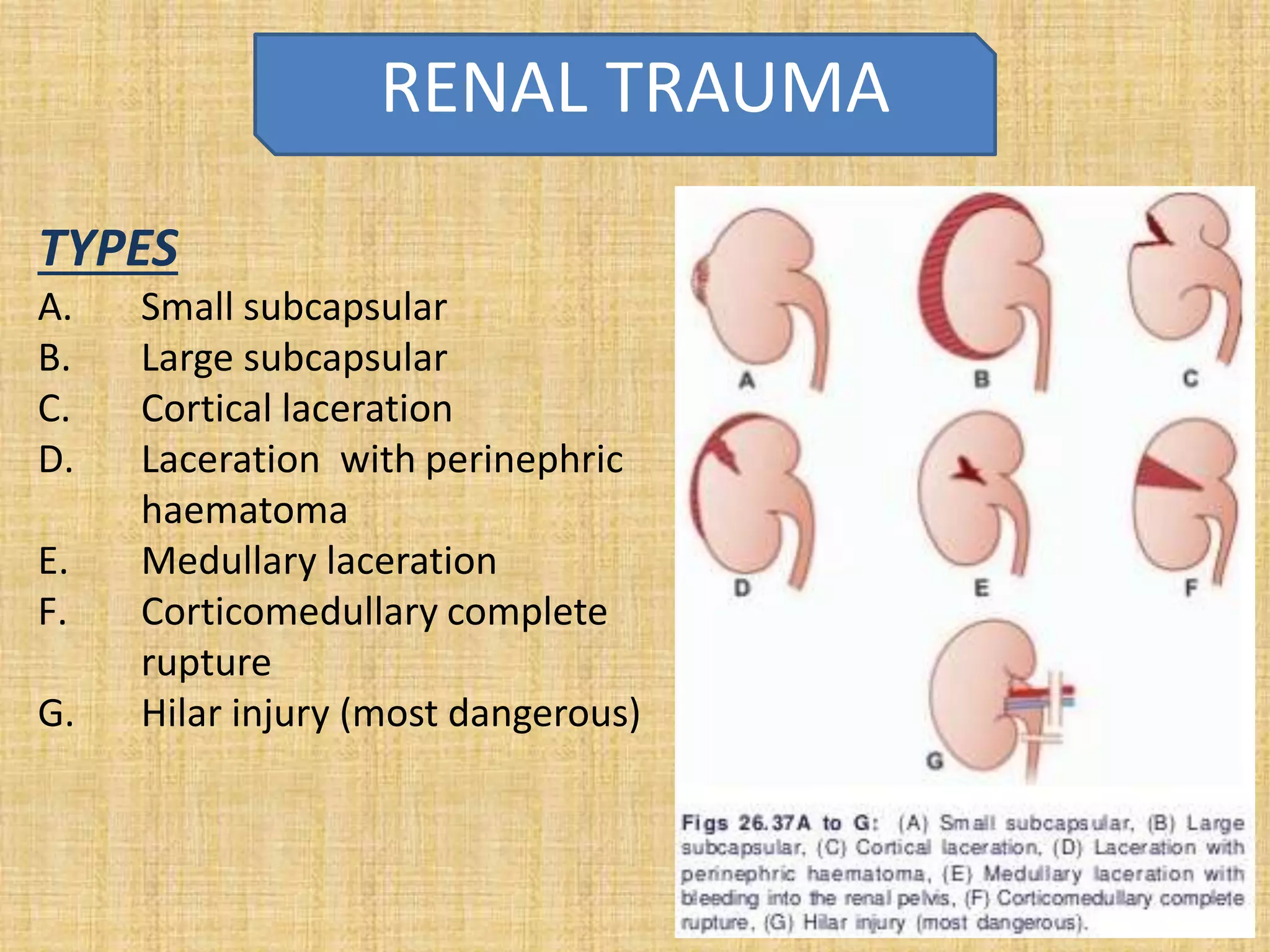 Blunt injury abdomen(renal trauma&mesenteric trauma) | PPTX