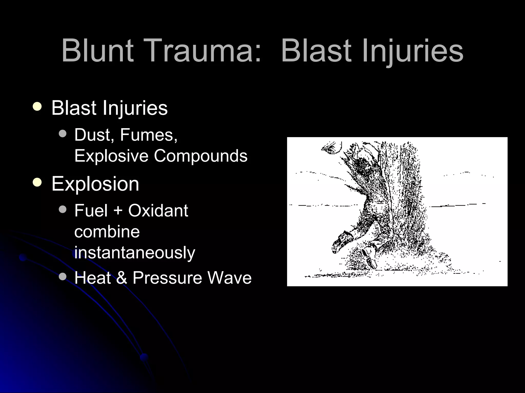 Blunt trauma | PPT