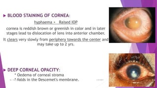 Blunt trauma of the eye | PPTX