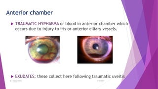Blunt trauma of the eye | PPTX