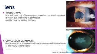 Blunt trauma of the eye | PPTX