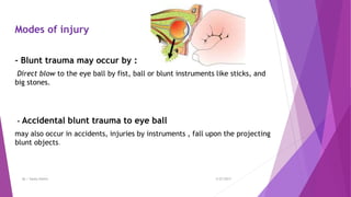 Blunt trauma of the eye | PPTX