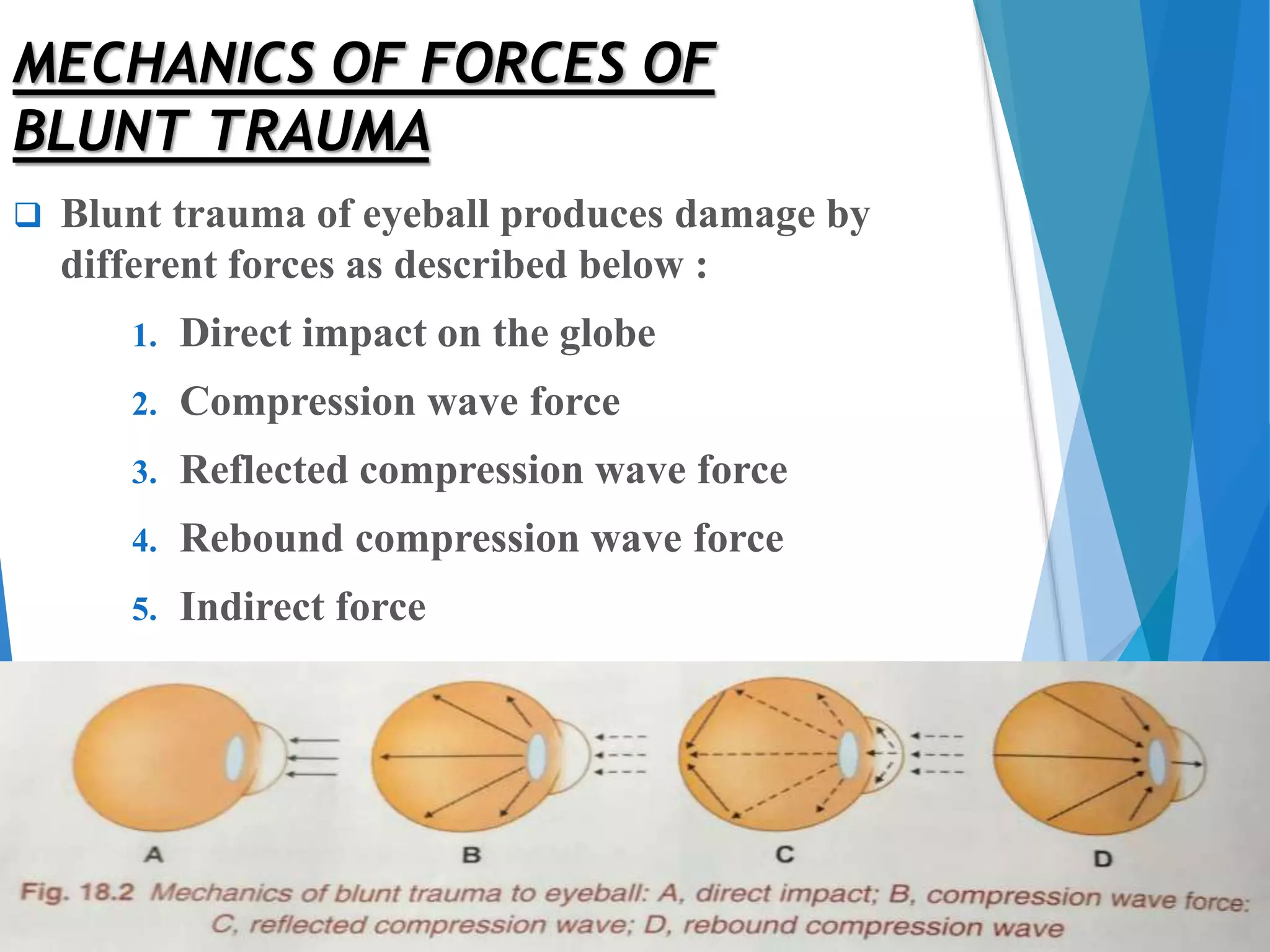 Blunt trauma of eye | PPTX