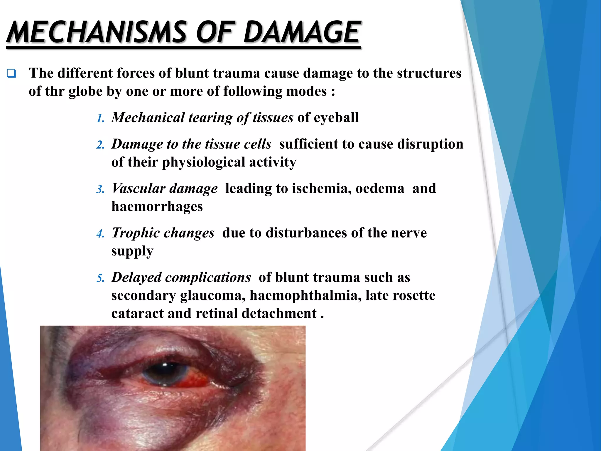 Blunt trauma of eye | PPTX | Death, Injury, or Military Conflict ...