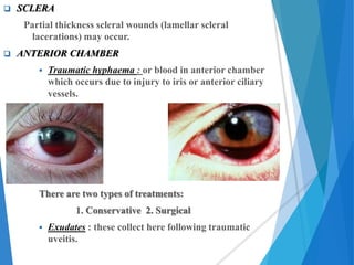 Blunt trauma of eye | PPTX