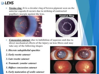 Blunt trauma of eye | PPTX | Death, Injury, or Military Conflict ...