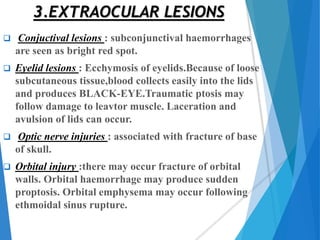 Blunt trauma of eye | PPTX