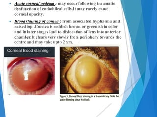 Blunt trauma of eye | PPTX