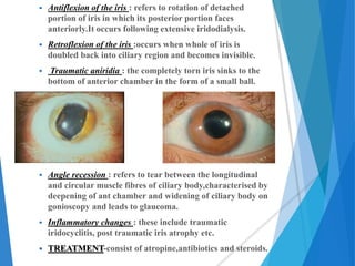 Blunt trauma of eye | PPT