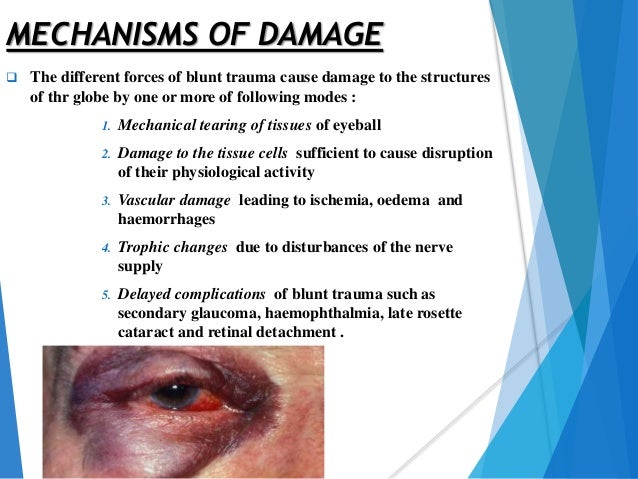 Blunt trauma of eye