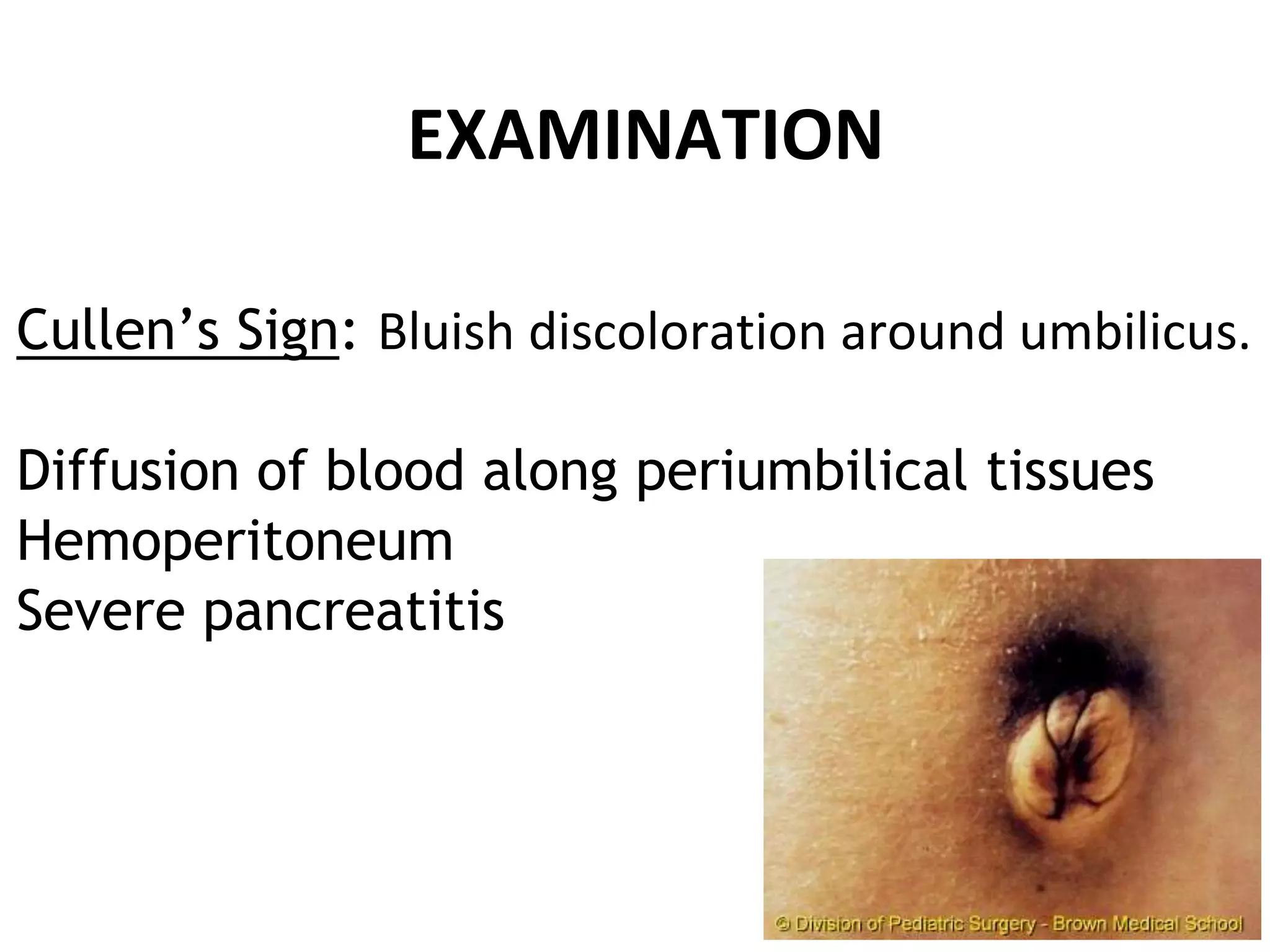Blunt trauma abdomen | PPTX