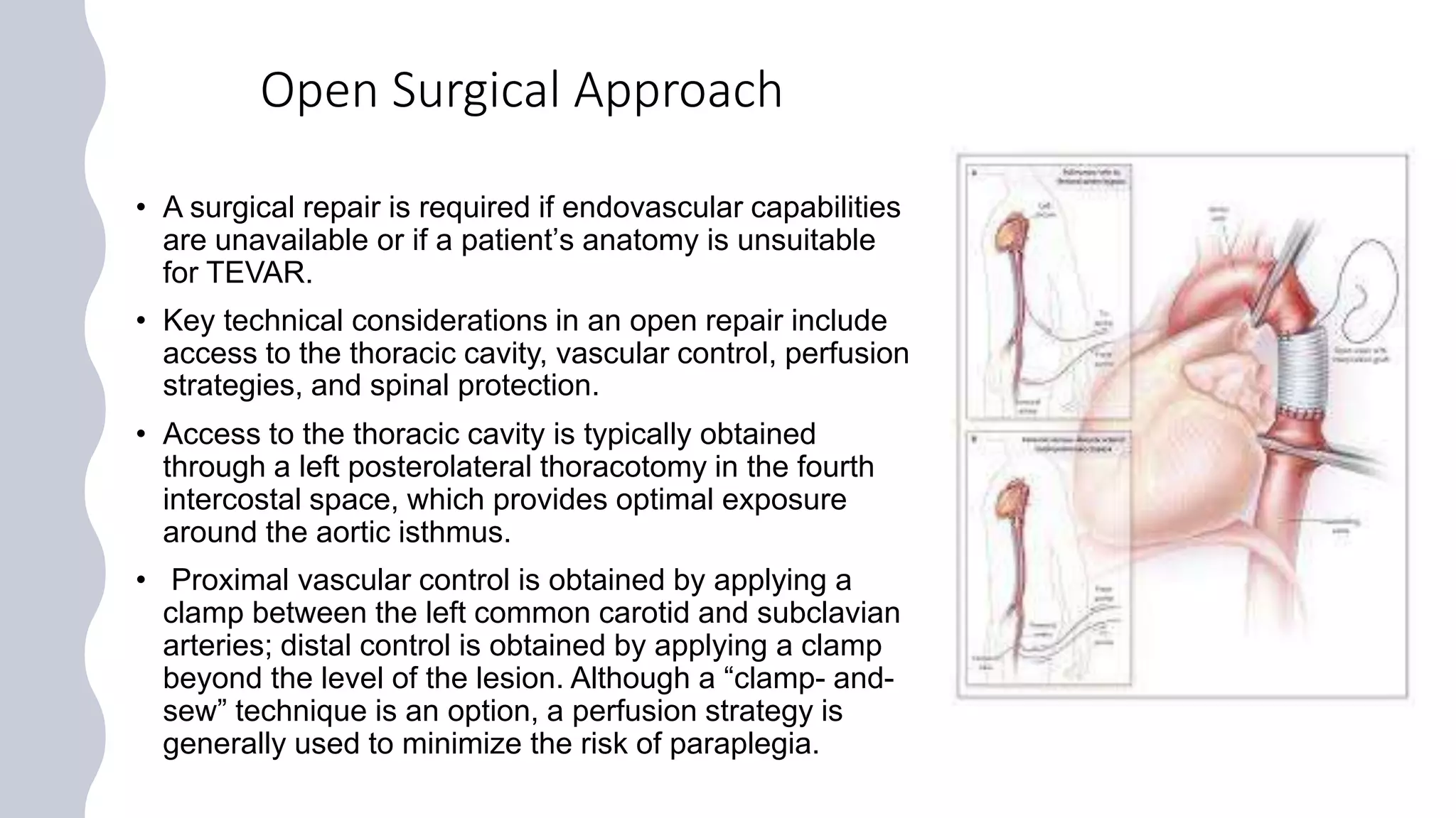Blunt Thoracic Aortic Injury BTAI | PPSX