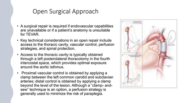 Blunt Thoracic Aortic Injury BTAI | PPSX | First Aid | Injuries