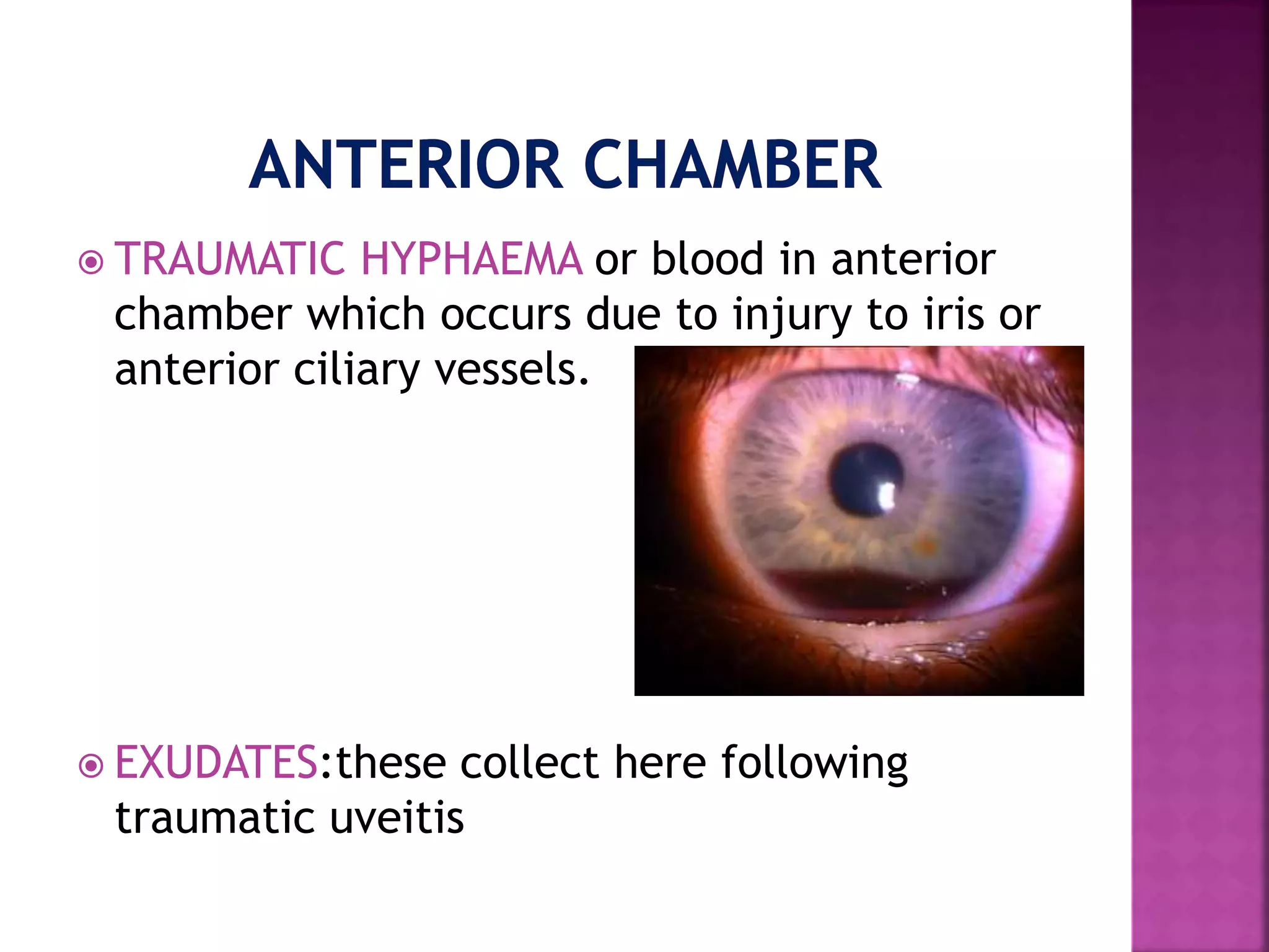 Blunt trauma to eye | PPTX