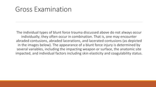 blunt trauma wounds-2.pptx