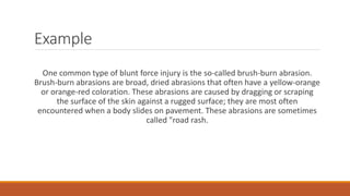 blunt trauma wounds-2.pptx