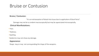 blunt trauma wounds-2.pptx