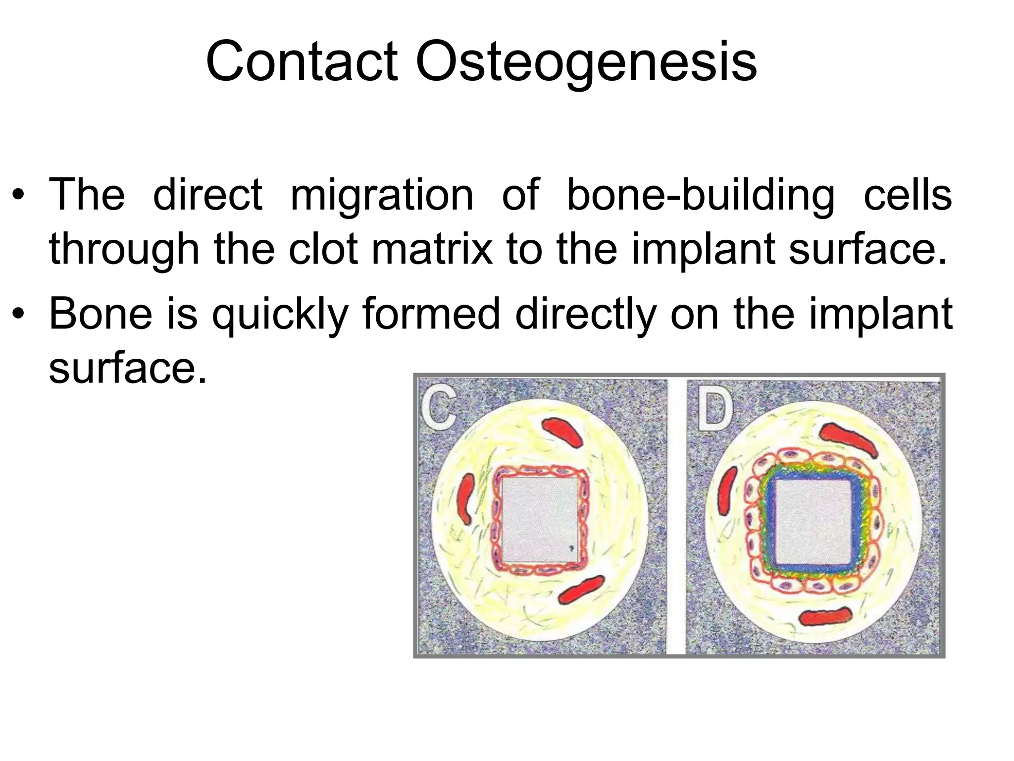 Osseointegration | PPTX