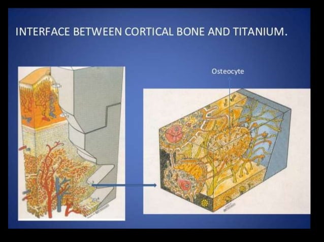 Osseointegration | PPTX | Bone and Joint Conditions | Diseases and ...