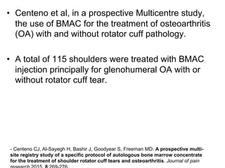 BMAC in cuff repairs | PDF