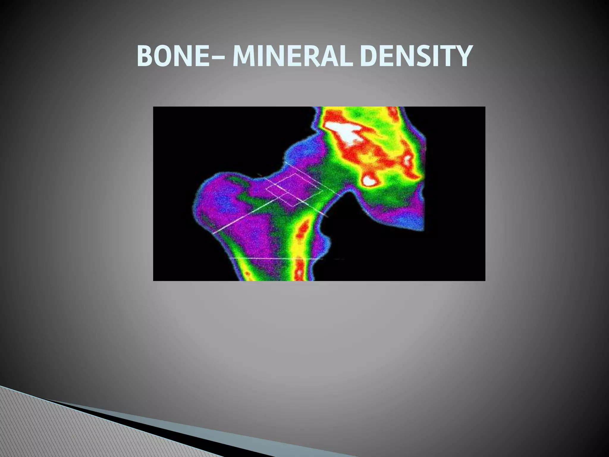 Bone marrow density (BMD) | PPTX
