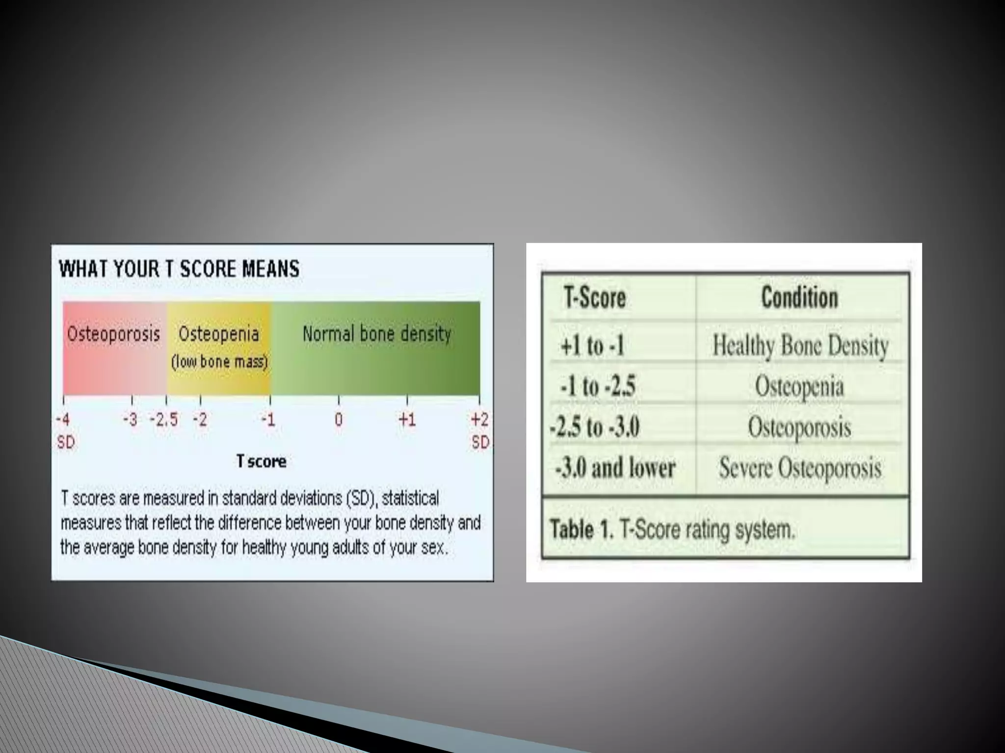 Bone marrow density (BMD) | PPTX