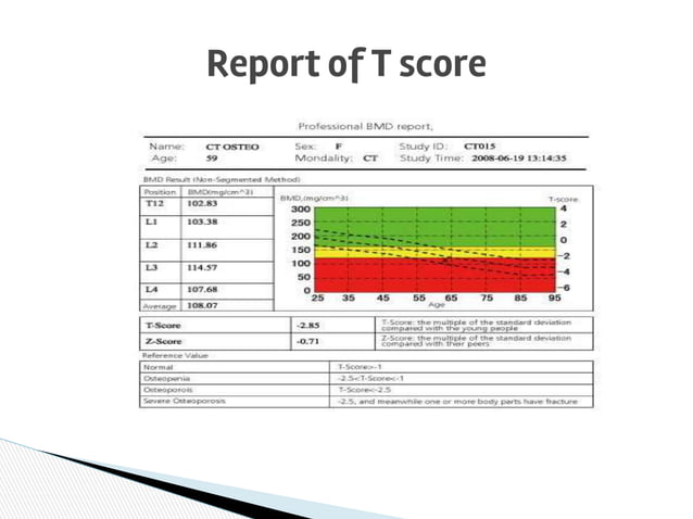 Bone marrow density (BMD) | PPTX