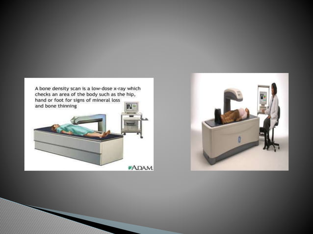 Bone marrow density (BMD) | PPTX