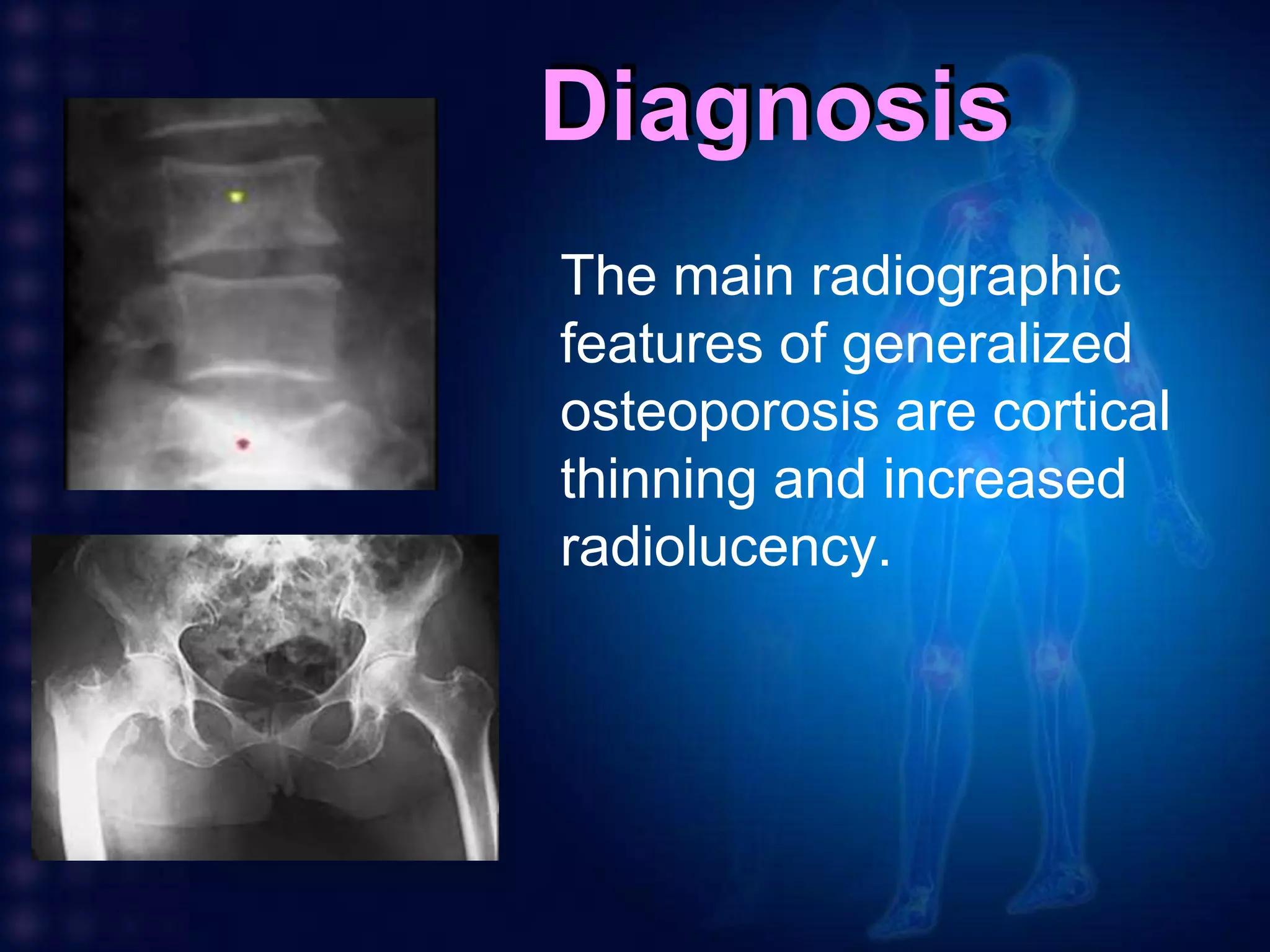 Bone Mineral Density | PPTX