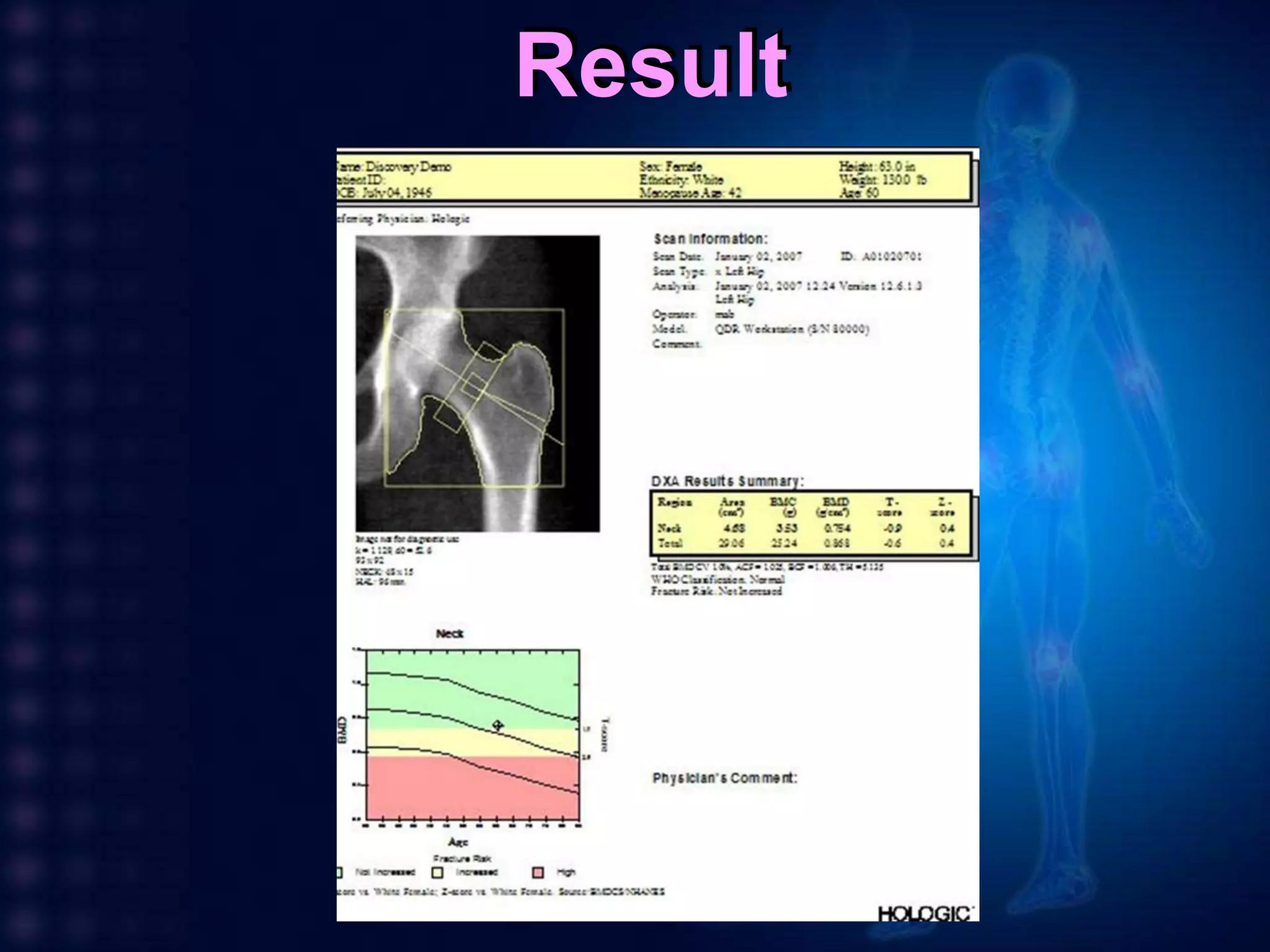Bone Mineral Density | PPTX