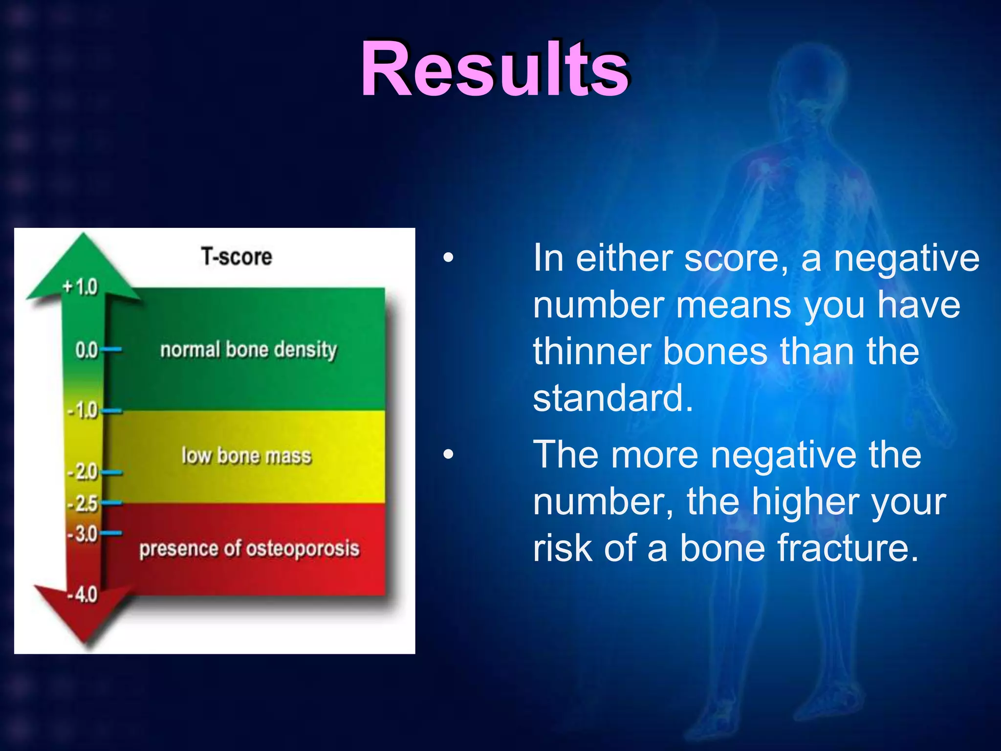 Bone Mineral Density | PPTX